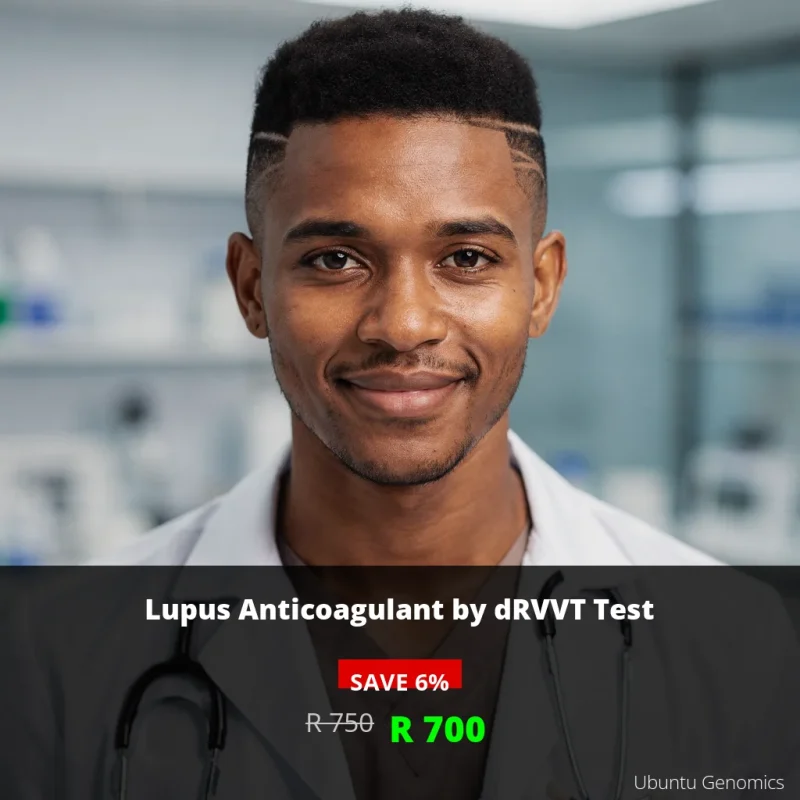 Lupus Anticoagulant Test ZAR 700 | Detect Blood Clotting Disorders ...